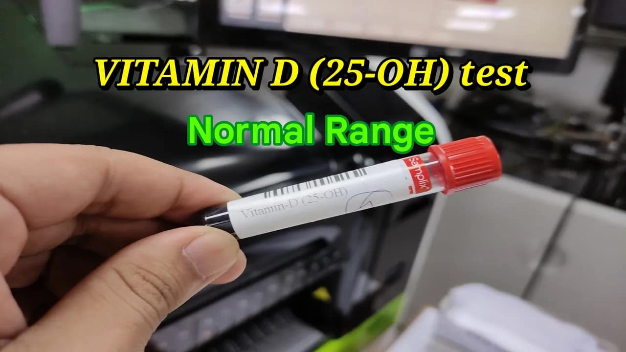 ভিটামিন ডি নরমাল লেভেল কত? ভিটামিন ডি কমে গেলে কি হয়? ভিটামিন ডি বেড়ে ...